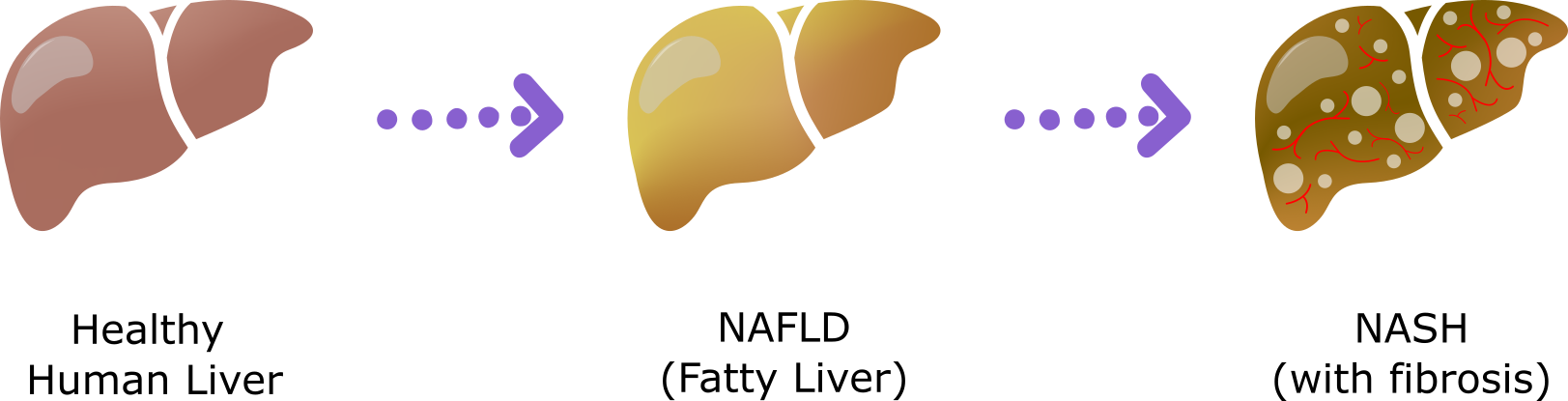Targeting Nash Drug Development With A New Humanized Liver Nash Model